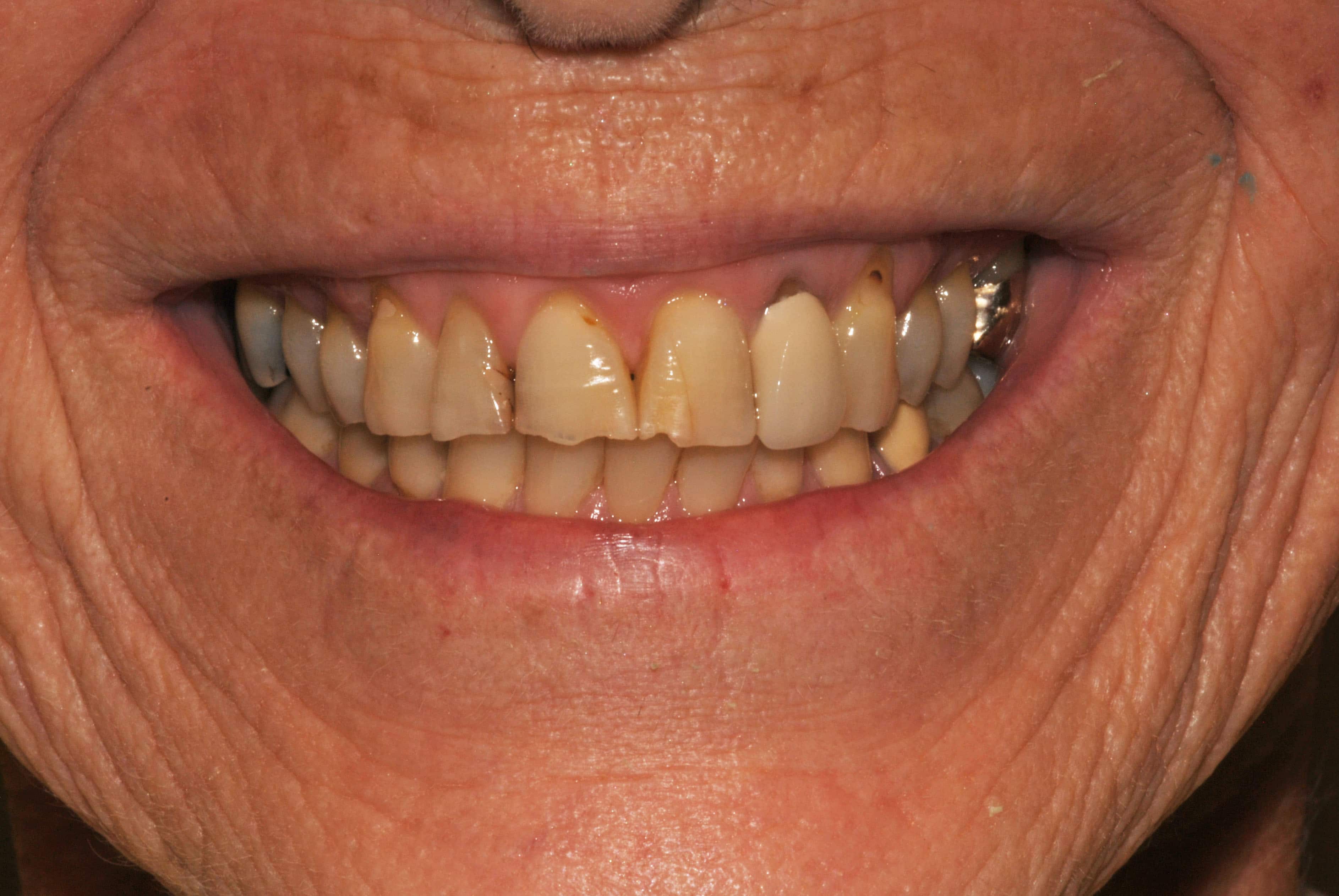 Testimonials - South Tulsa Dental